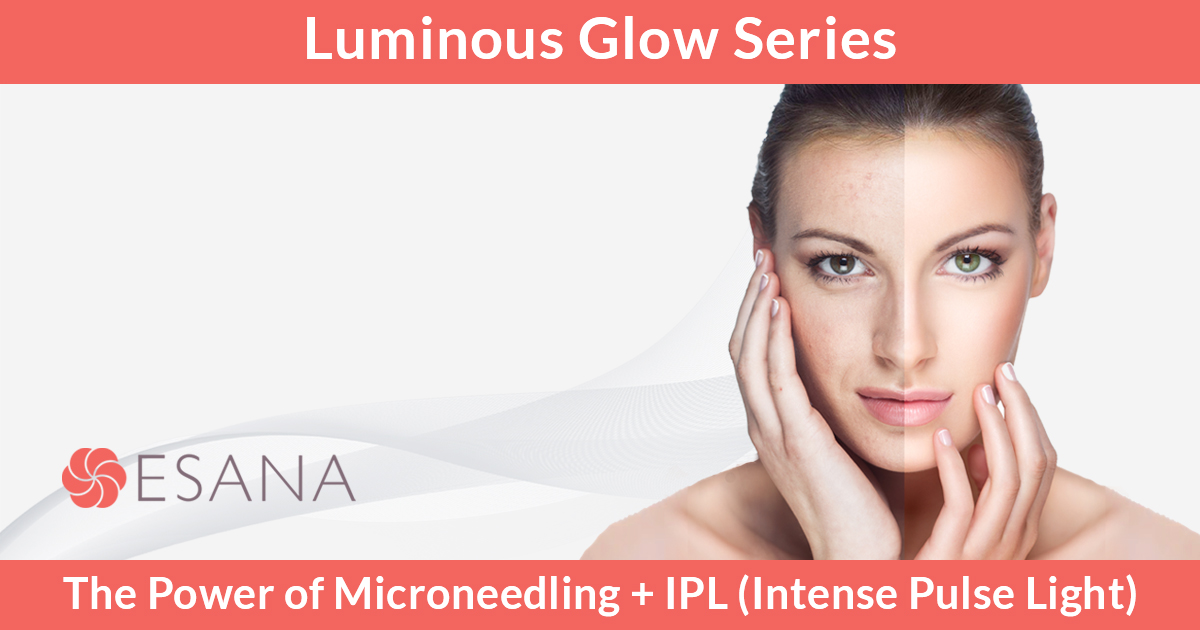 Luminous Glow Series: Microneedling + IPL (Intense Pulse Light) - ESANA
